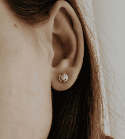Different Types of Otoplasty: A Comprehensive Guide | Dr. Amir Sadri Different Types of Otoplasty: A Comprehensive Guide | Dr. Amir Sadri